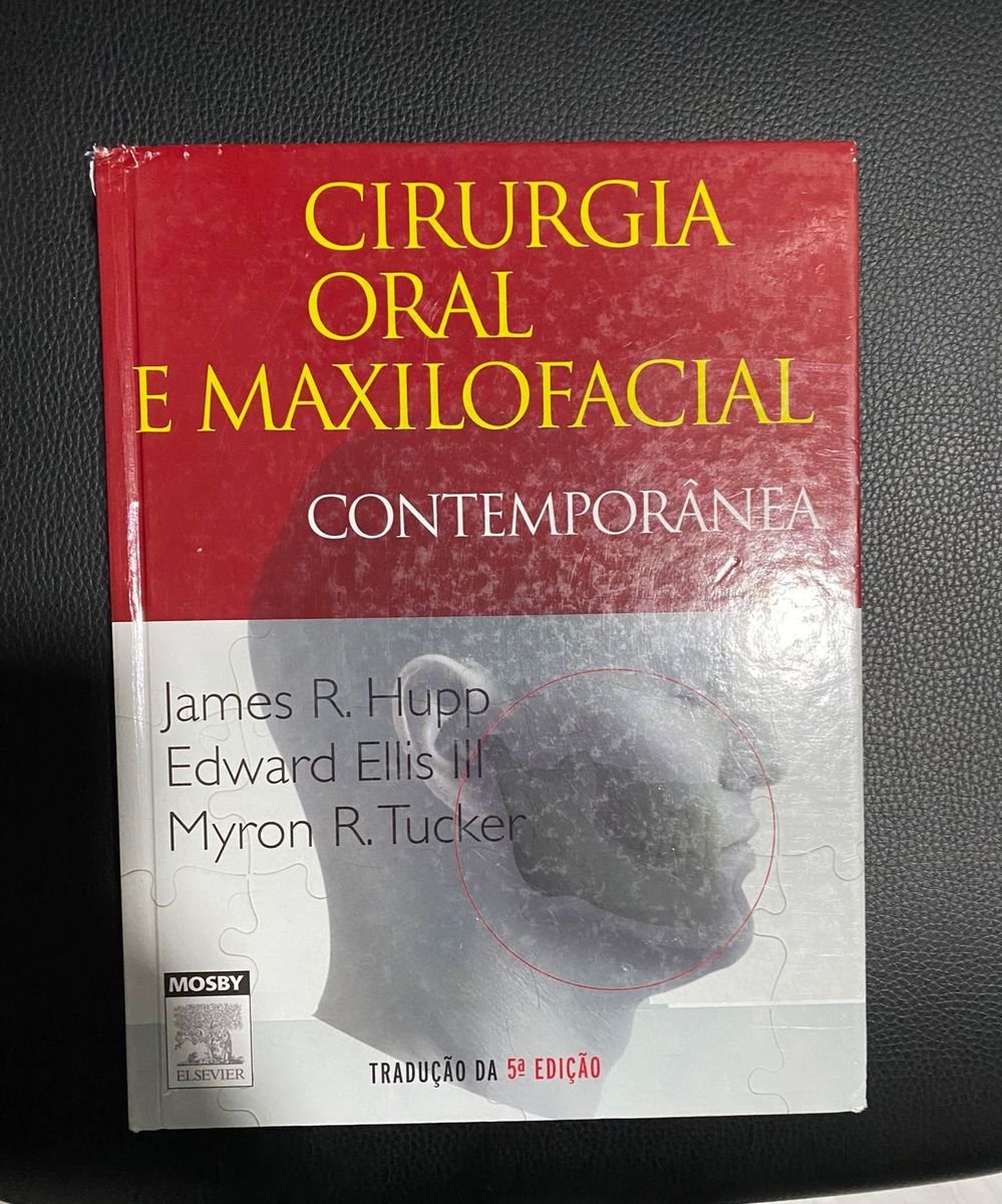 Livro Cirurgia Oral Maxilofacial Contemporânea Hupp 5ª Edição | Livro ...