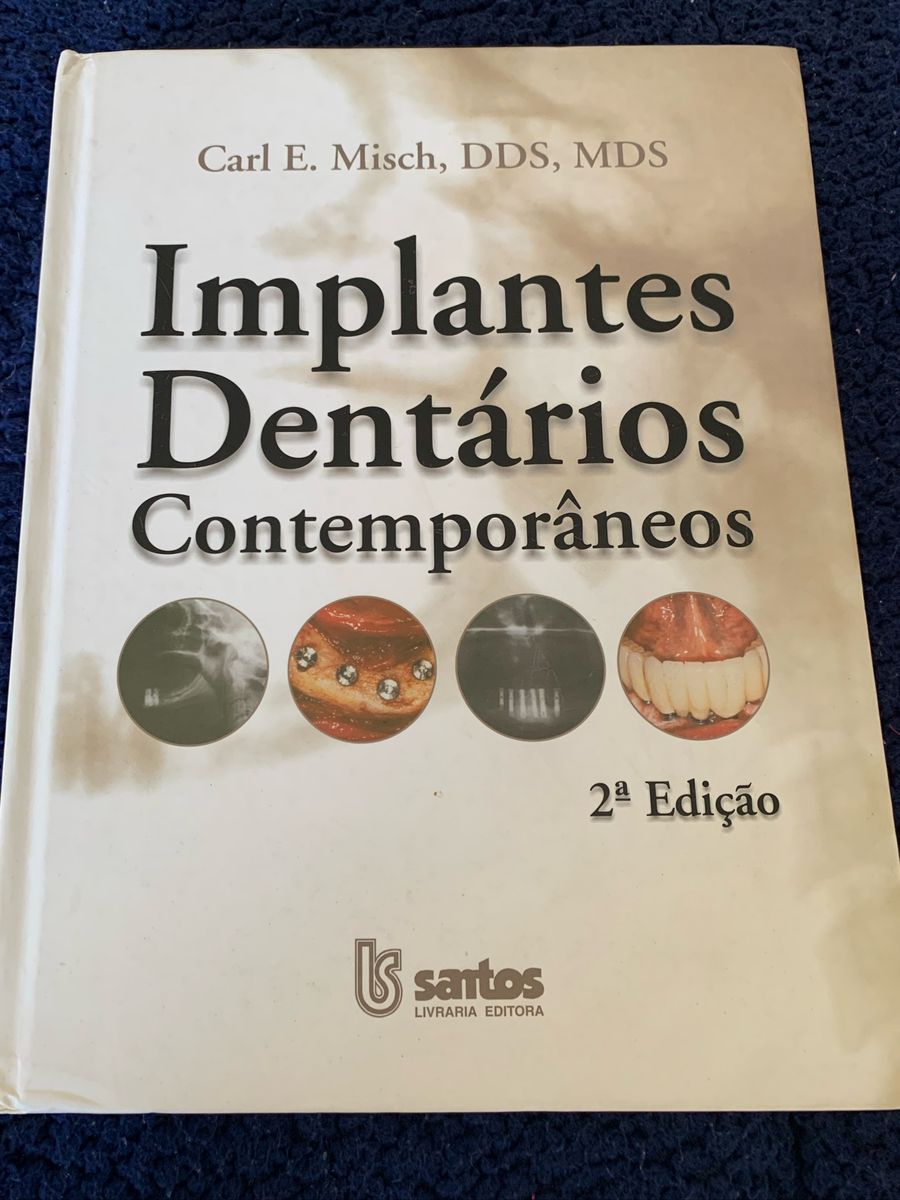 Livro de Carl Misch - Implantes Dentários Contemporâneos de 2006 ...