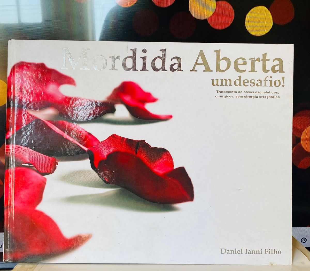 Livro Mordida Aberta, Um Desafio! | Livro Daniel Ianni Filho Nunca ...