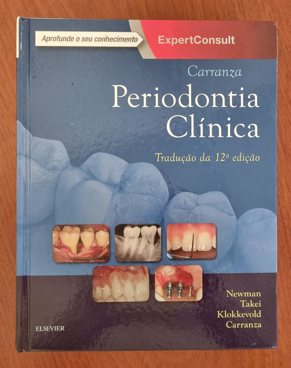 Livro Periodontia Clínica- Carranza | Item Info & Eletro Periodontia ...