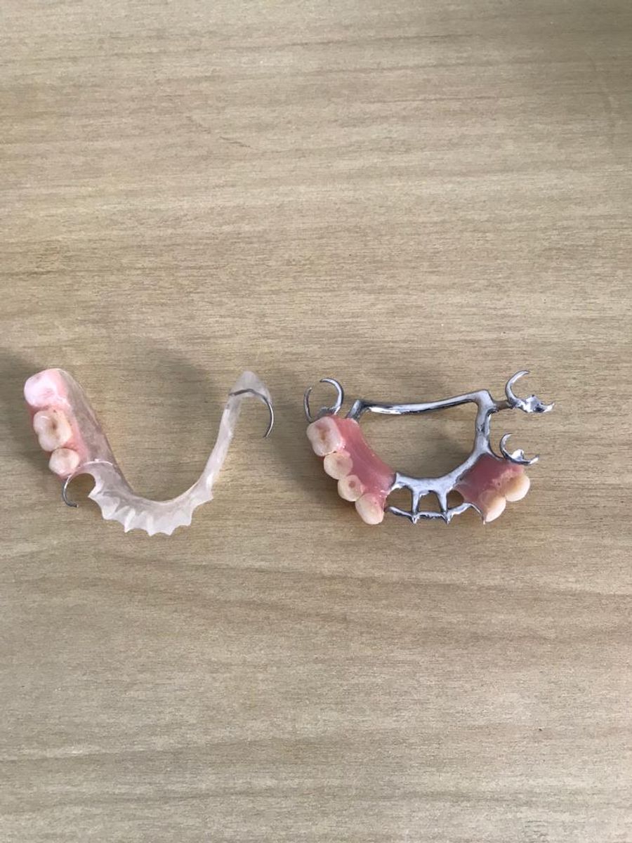 Odonto: Ppr Superior e Acrílica Inferior | Cacareco Artesanal Usado ...